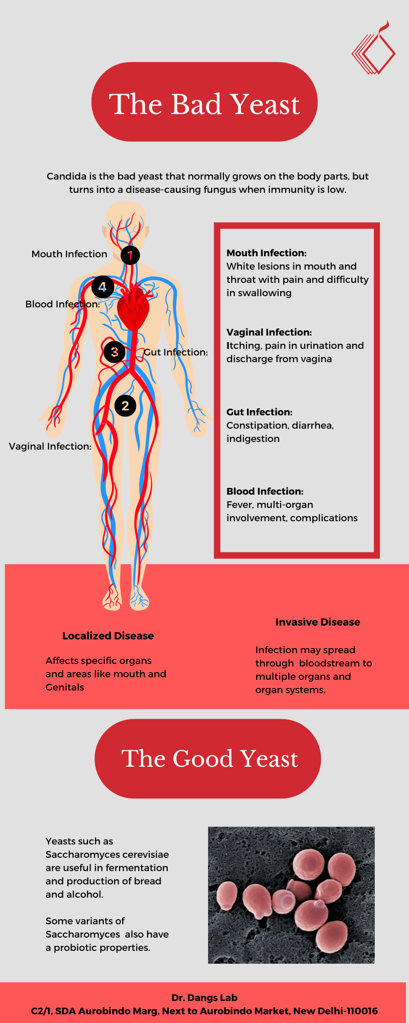 Candida Stomach Infection Candidal Intertrigo — DermNet