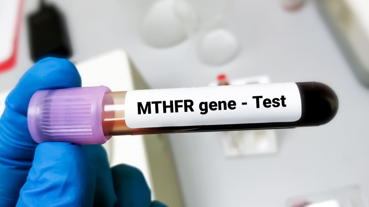 MTHFR Gene Mutation Test in Delhi & MTHFR Test Gurgaon